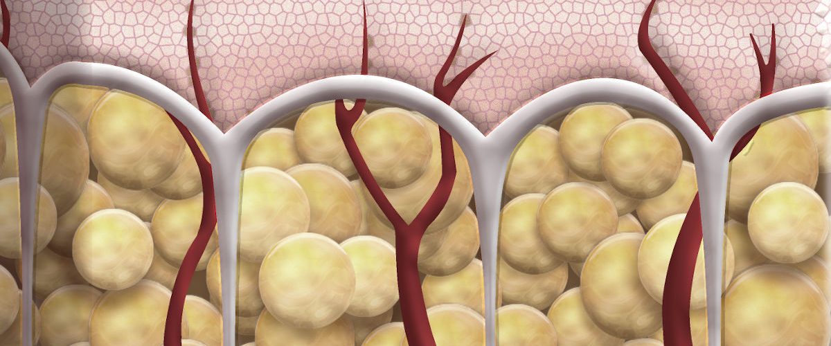 Septos fibrosos: la clave de la flacidez | Consejos IML
