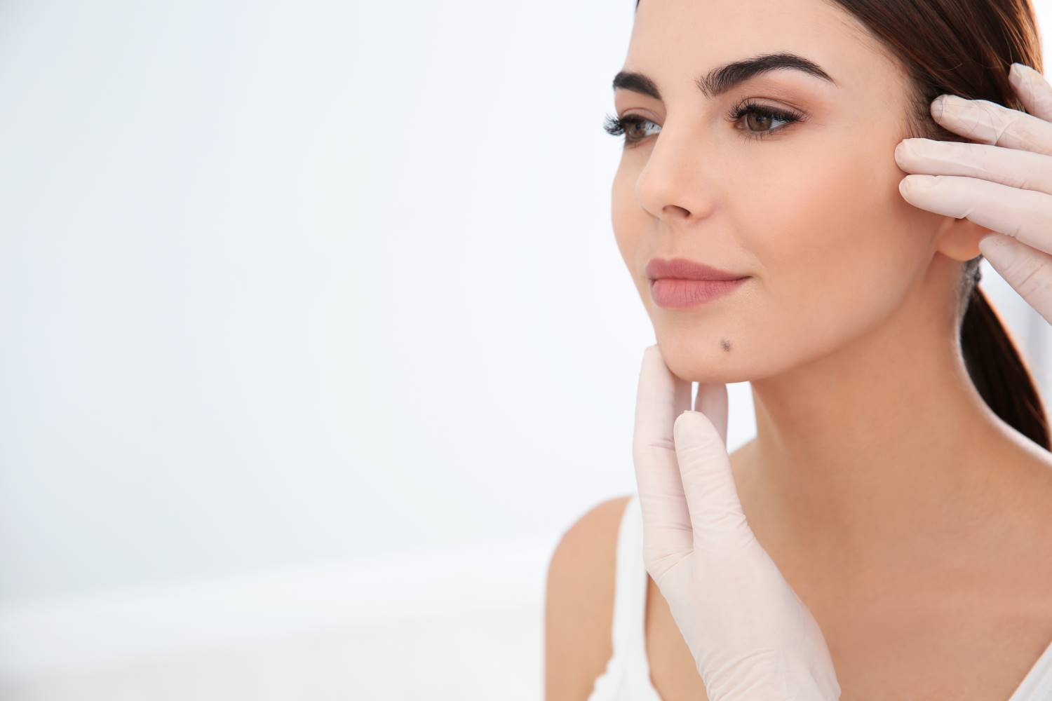 Cómo tratar un nevus en la cara, las mejores técnicas | IML