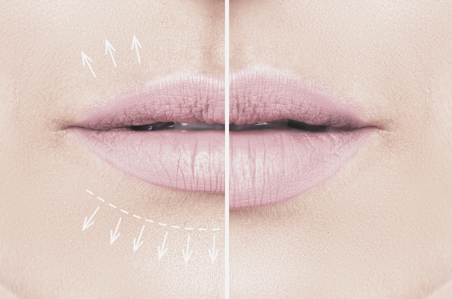 ¿Cómo conseguir unos labios perfectos y naturales? | IML